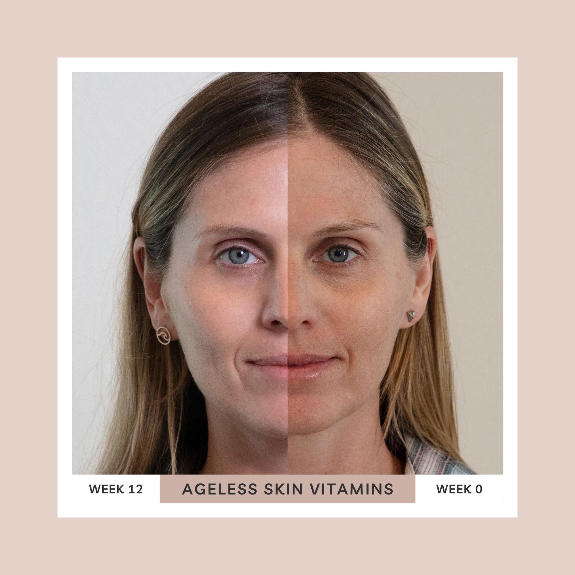 Ageless Skin Vitamins – well i am store